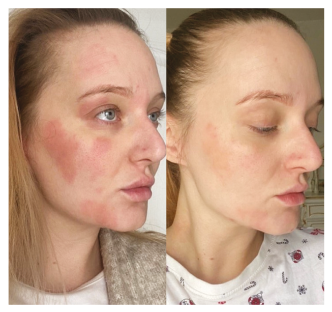 SORTED SKIN – Sorted Skin