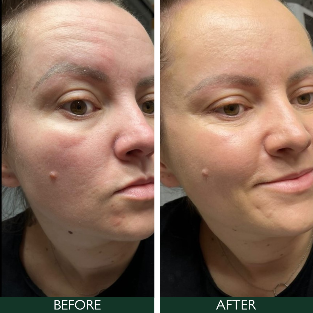 5 IN 1 ANTI-REDNESS DAY CREAM SPF50 – Sorted Skin