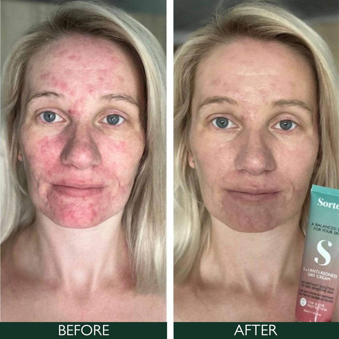 SORTED SKIN – Sorted Skin