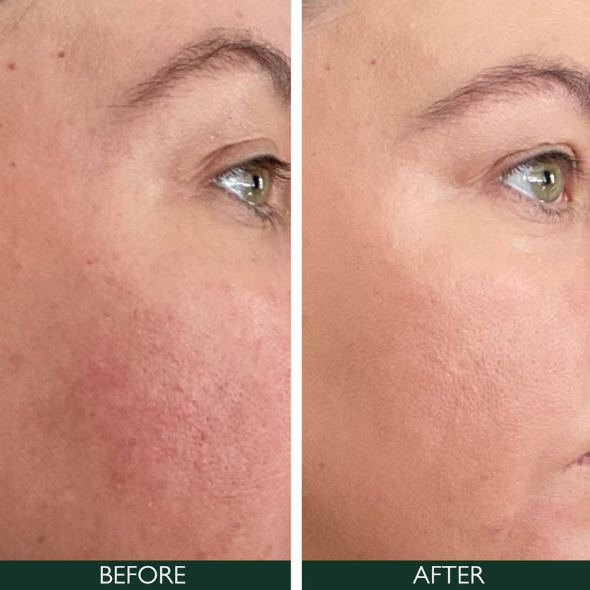 5 IN 1 ANTI-REDNESS DAY CREAM SPF50 – Sorted Skin