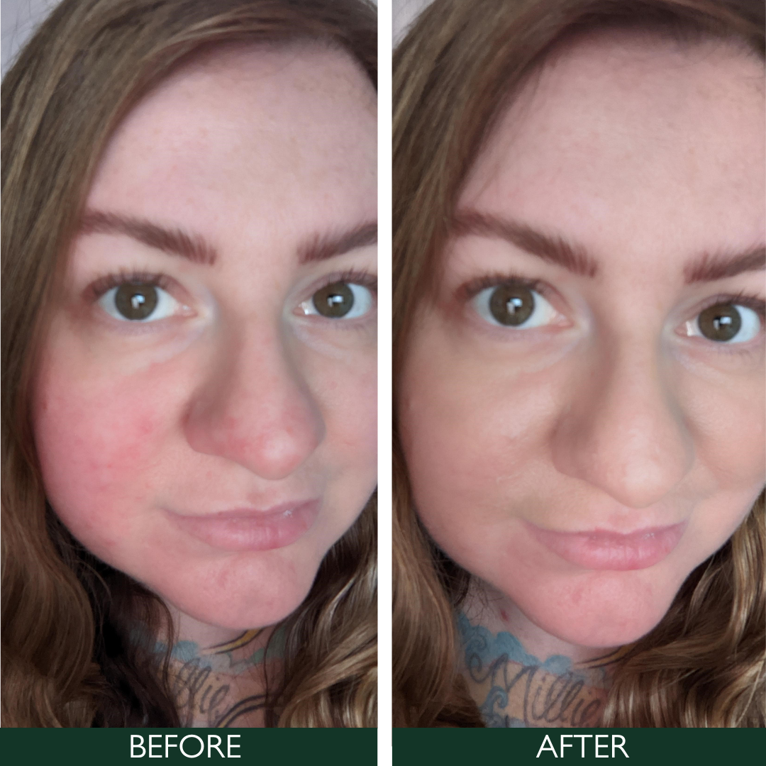 5 IN 1 ANTI-REDNESS DAY CREAM SPF50 – Sorted Skin